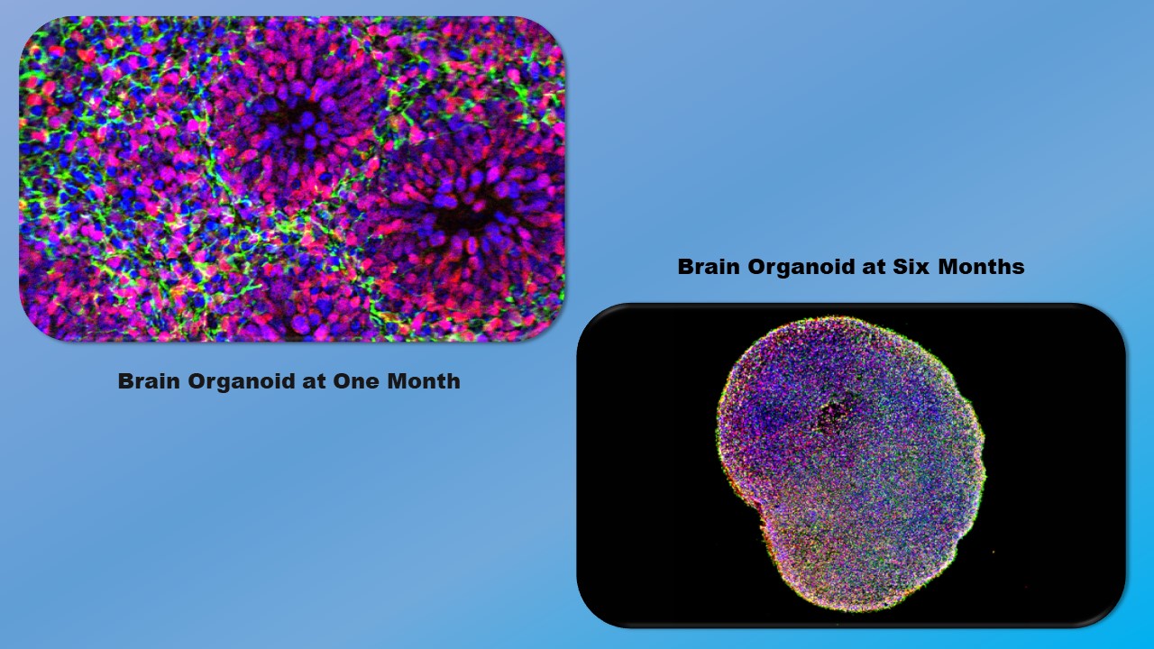 New models accelerate human brain research while sparking debate ...